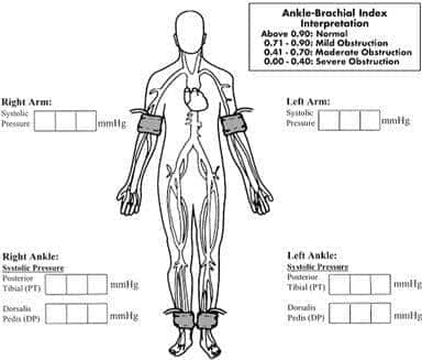 The ankle-brachial index (ABI) calculator